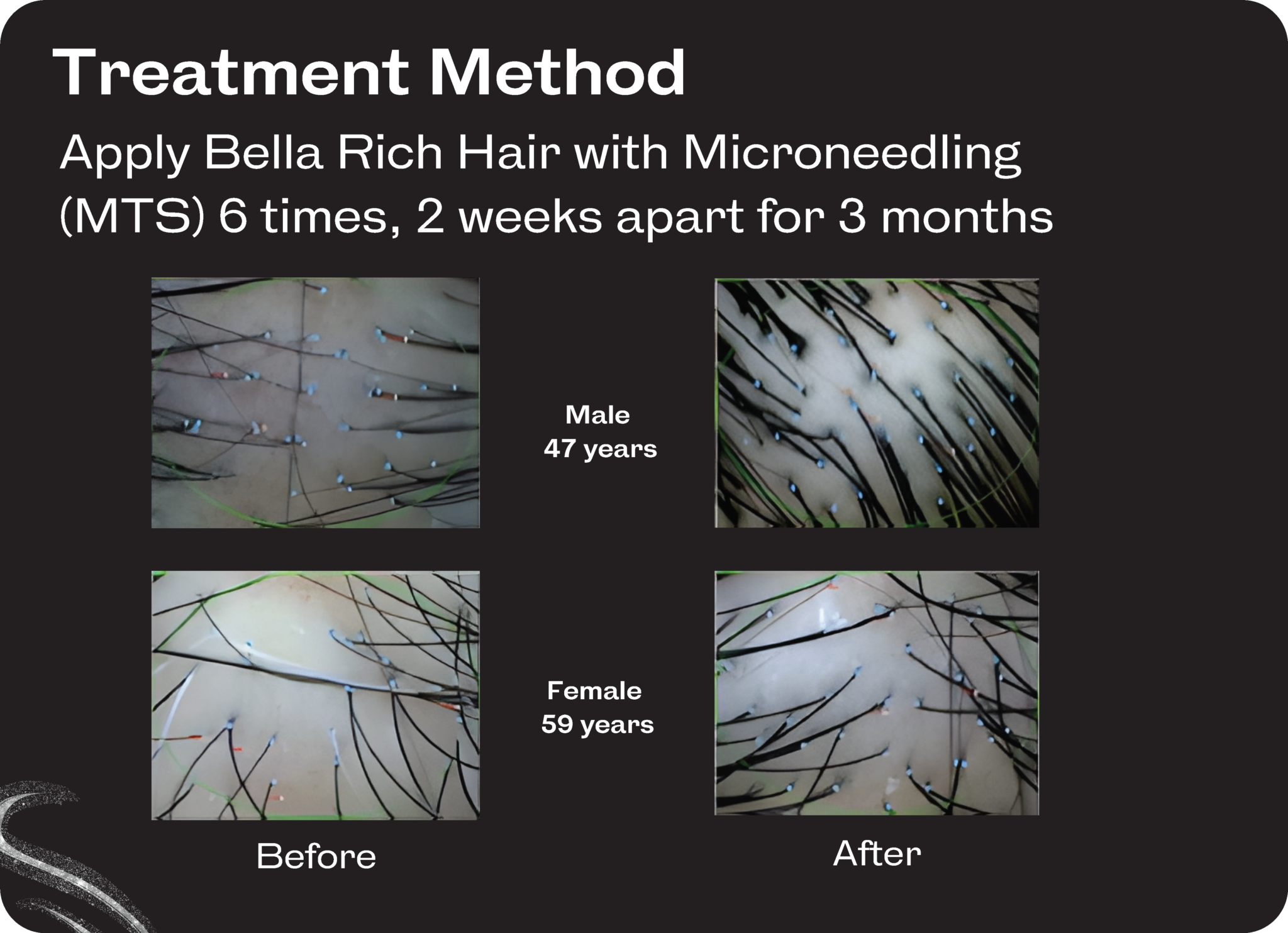Bella Rich Hair – MDMC Co., Ltd.