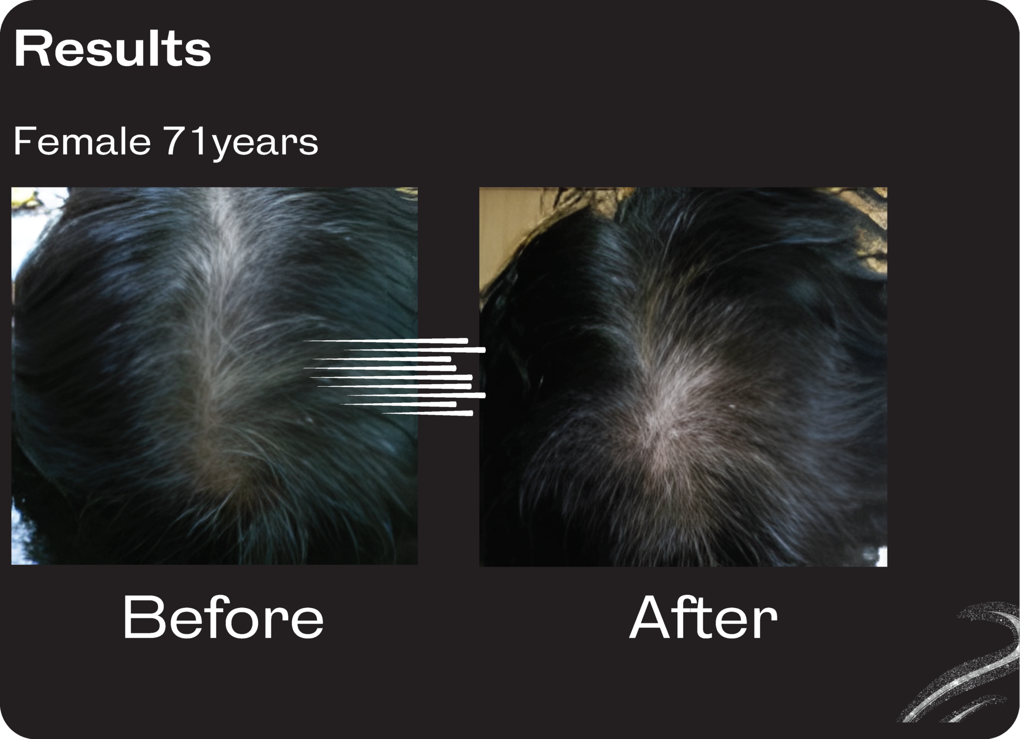 Bella Rich Hair – MDMC Co., Ltd.